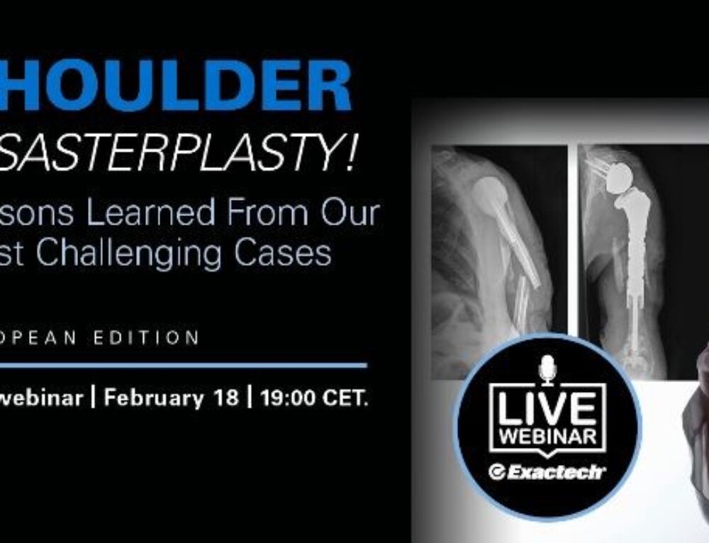 Neue Klassifikation der Omarthrose nach Habermeyer/Samilson - Deutsches ...